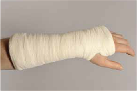 Värttinäluun distaalisten murtumien nykyhoito