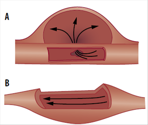 Sykkivä sarvi otsalla