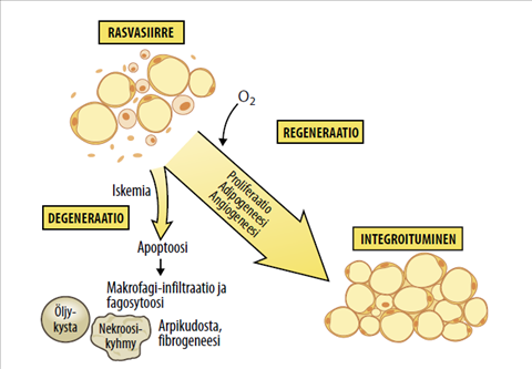 Rasvansiirto - korjaavan kirurgian yleistyvä työkalu