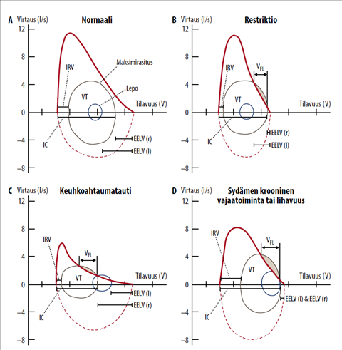 Spiroergometria fyysisen suorituskyvyn ja sitä rajoittavien tekijöiden arvioinnissa