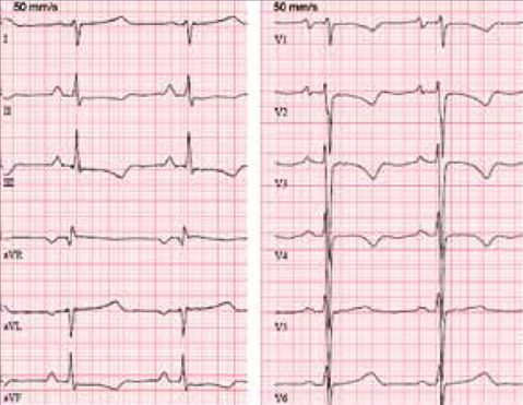 Kuusivuotiaan tytön pitkittynyt vatsakipu ja oksentelu