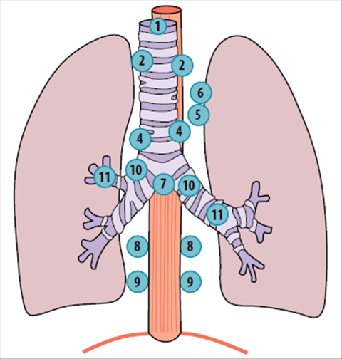 Hyvä näytteenotto keuhkosyövän diagnostiikassa ja levinneisyyden arviossa