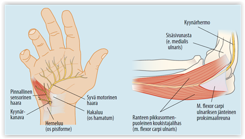 Yläraajan yleisimmät hermopinteet