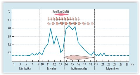 Tuhkarokko - unohtuva uhka