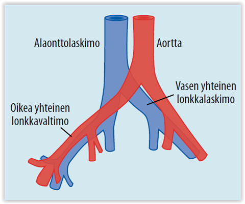 Raskaus ja laskimotukos