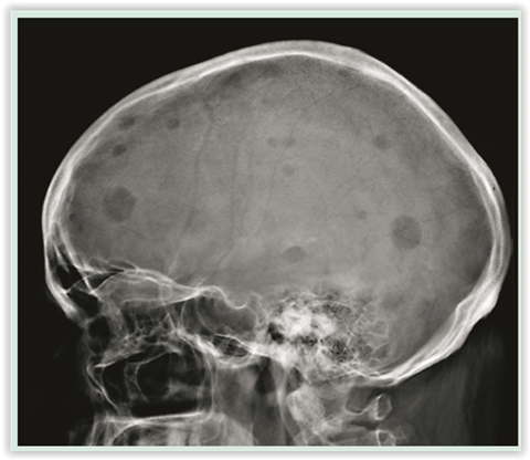 Kliininen hematologia - tietolaatikko
