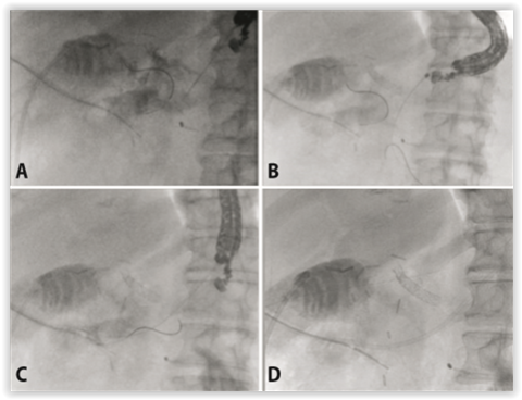 Endoskooppinen kaikukuvaus keskussairaalassa