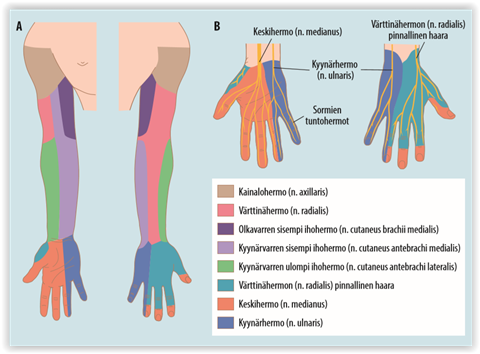 Yläraajan tapaturmaiset hermovammat