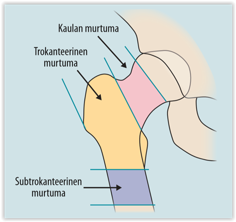 Lonkkamurtumapotilaan kuntoutus