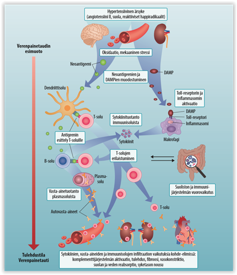 Nostaako krooninen tulehdus verenpainetta?
