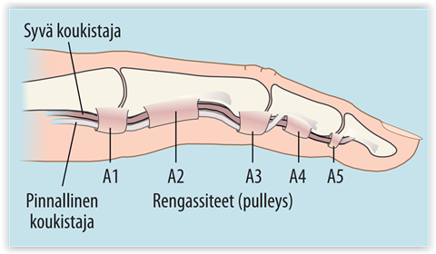 Sormien jännevammat