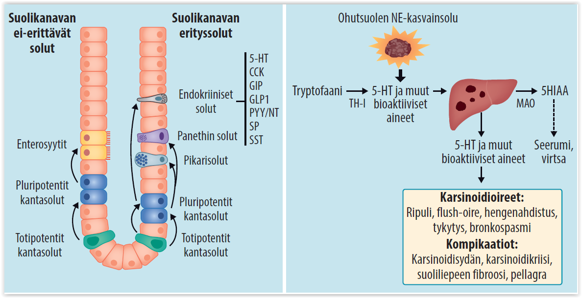 Ohutsuolen ja umpilisäkkeen neuroendokriiniset kasvaimet