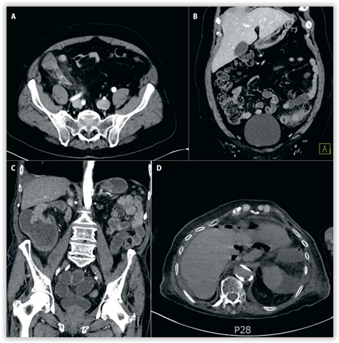 Akuutin vatsan diagnostiikka