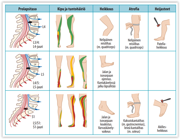 Iskiasoirepotilas perusterveydenhuollossa
