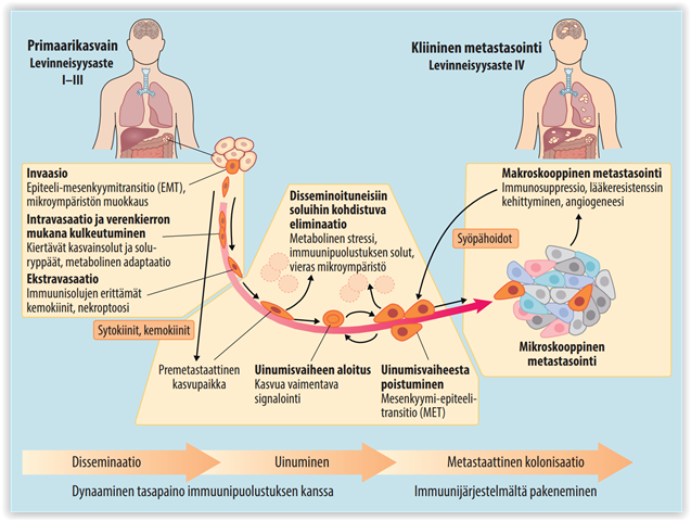 Miten ja miksi syöpä leviää?