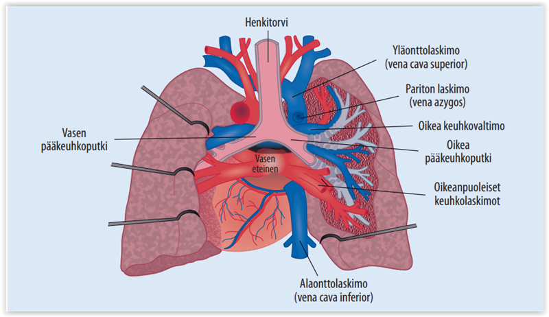 Keuhkoembolia sattumalöydöksenä keuhkoputkien kaikutähystyksessä
