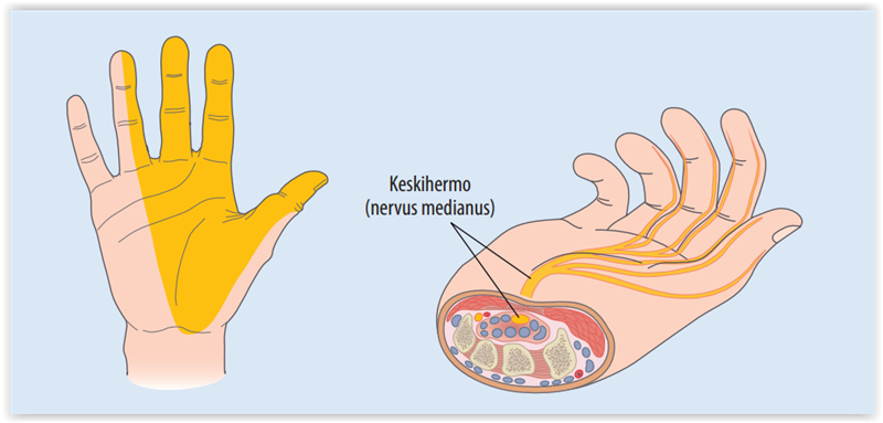 Rannekanavaoireyhtymä