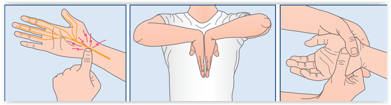 Rannekanavaoireyhtymä