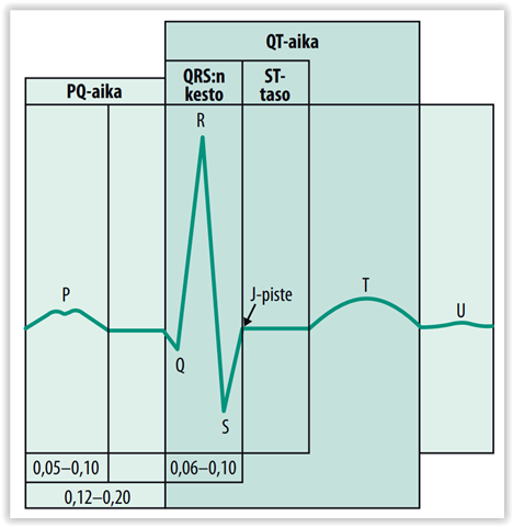 EKG-tulkinnan kompastuskivet