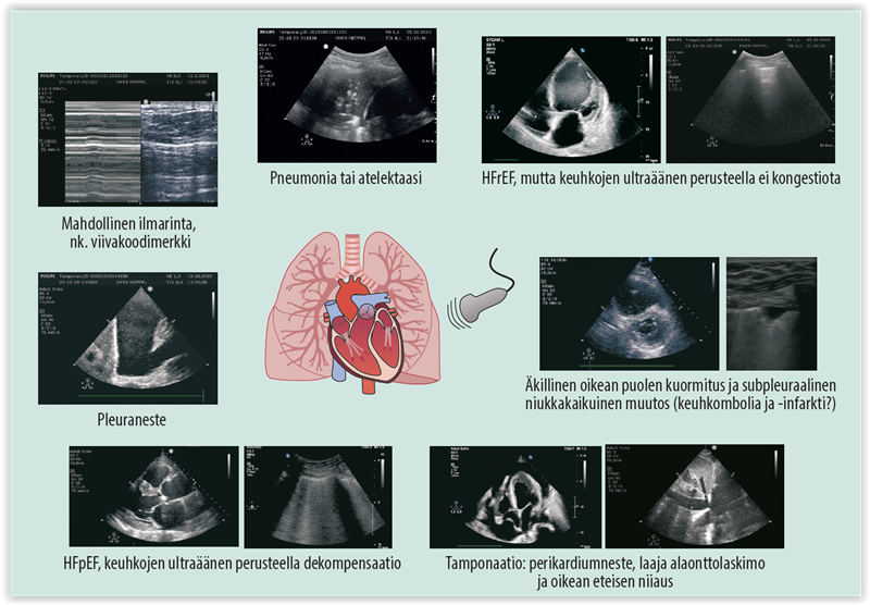 Päivystyspotilaan kajoamaton sydänkuvantaminen