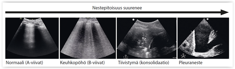 Päivystyspotilaan kajoamaton sydänkuvantaminen