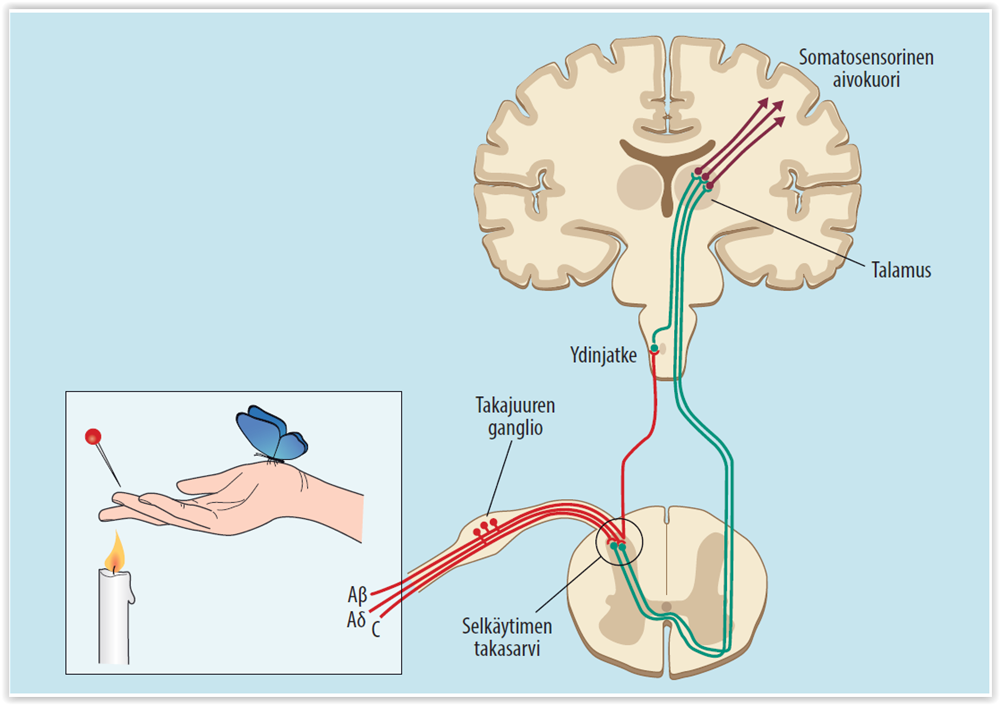 Mitä olemme oppineet neuropaattisen kivun synnystä?