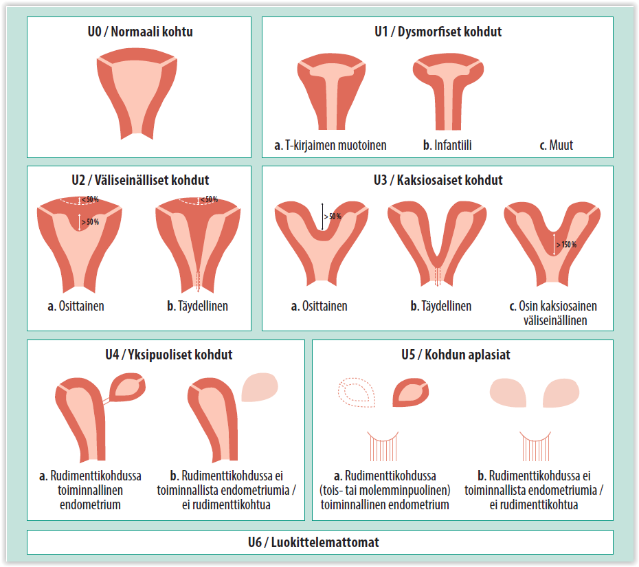 Kohdun synnynnäiset rakennepoikkeavuudet - onko niillä merkitystä?