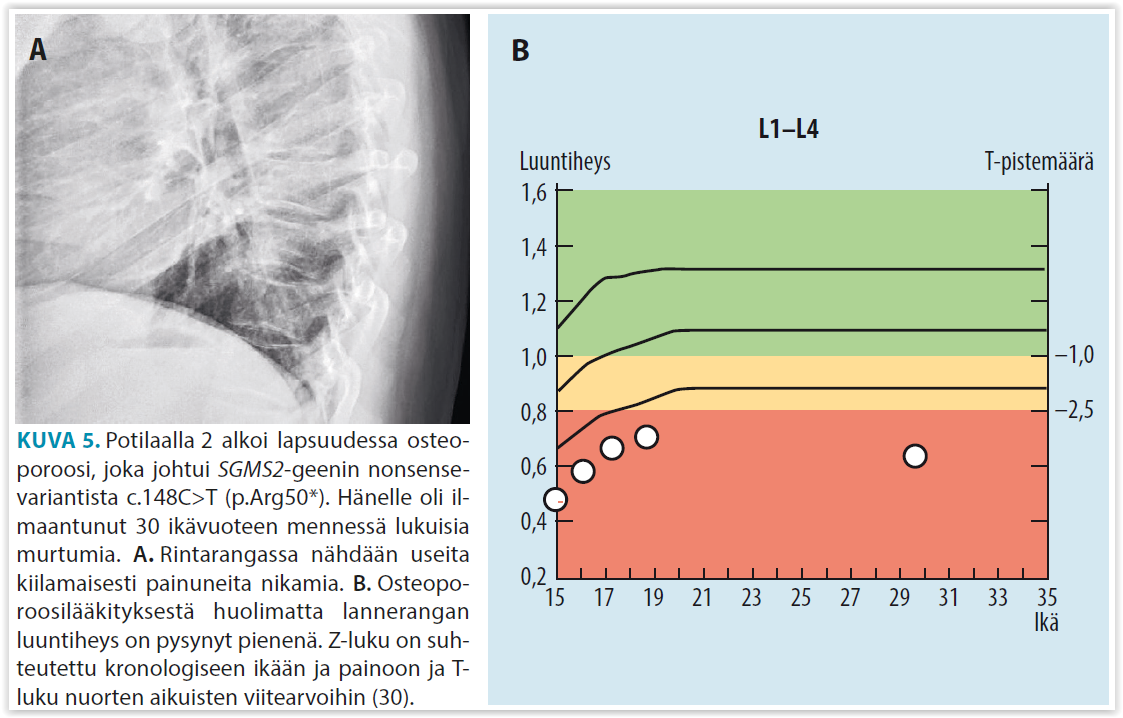 Perinnöllinen osteoporoosi