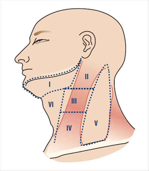 Kyhmy aikuisen kaulassa