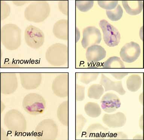 Plasmodium knowlesi, viides ihmiselle malariaa aiheuttava loislaji