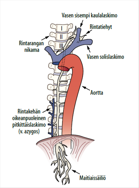 Kylothoraxin diagnoosi ja hoito