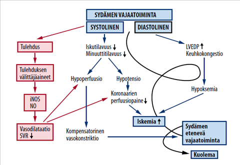 Kardiogeeninen sokki - sydäninfarktin vakava komplikaatio