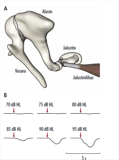 Mitä korvan ja kuuloratojen toimintatutkimukset kertovat kuulosta?