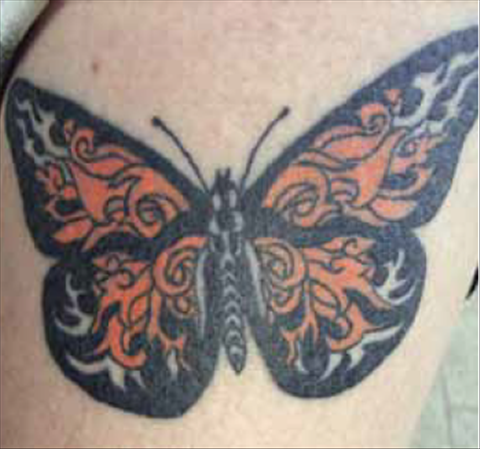 Tatuoinnit - mitä lääkärin tulee tietää?